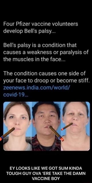 Four Pfizer vaccine volunteers develop Bell's palsy... Bell's palsy is ...