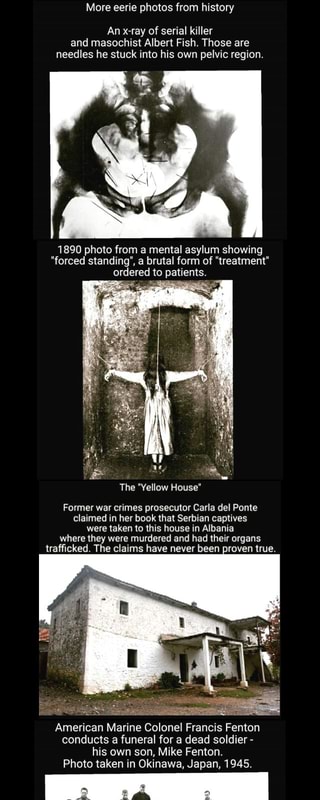 More eerie photos from history An x-ray of serial killer and masochist ...