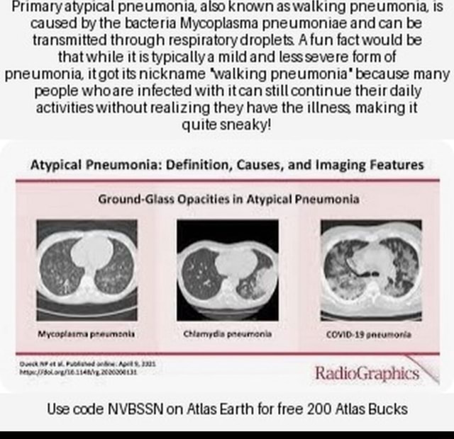 Primary atypical pneumonia also Known as walking pneumonia IS caused by ...