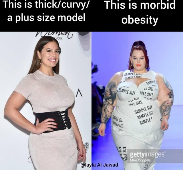This ts a plus size model This is morbid obesity Zypy, t "ESE MPLE siz ...