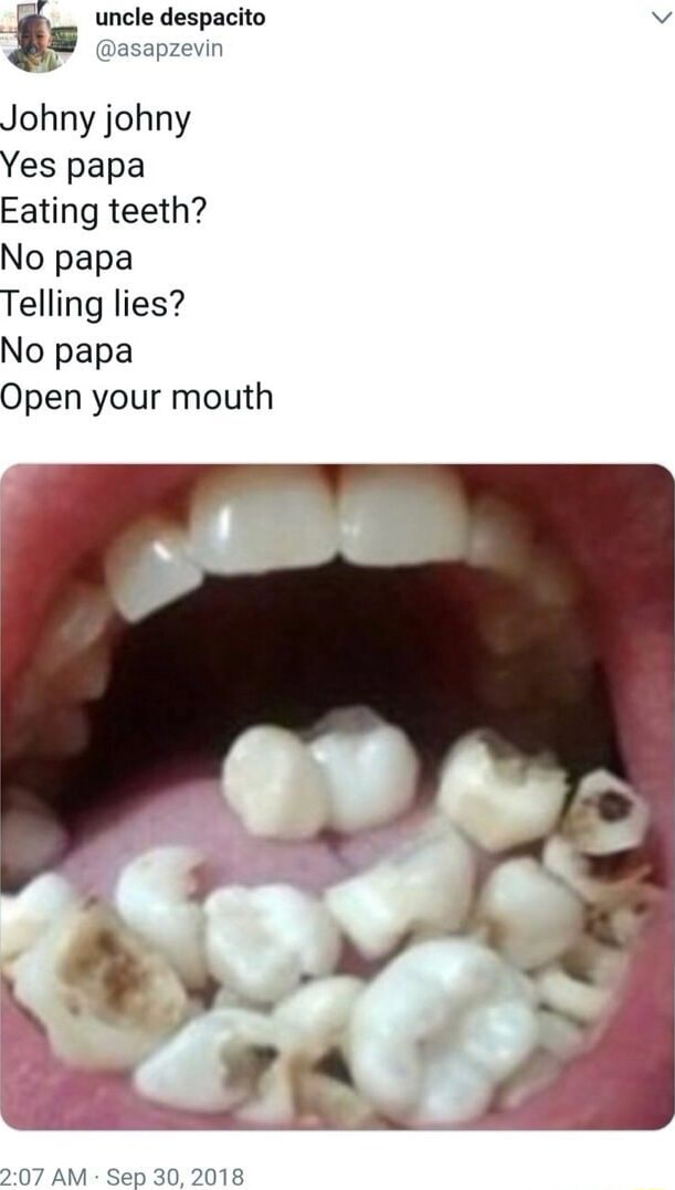 Uncle despacito Johny johny Yes papa Eating teeth? No papa Telling lies ...
