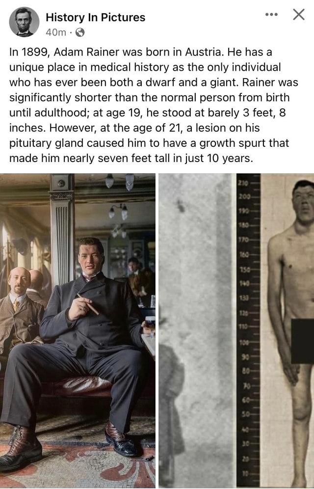 History In Pictures In 1899, Adam Rainer was born in Austria. He has a ...