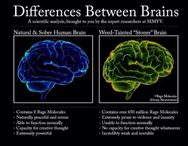 Differences Between Brains A scientific analysis, brought to you by the ...