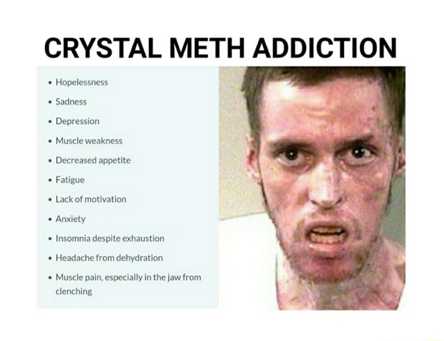 CRYSTAL METH ADDICTION Hopelessness Sadness Depression Muscle weakness ...