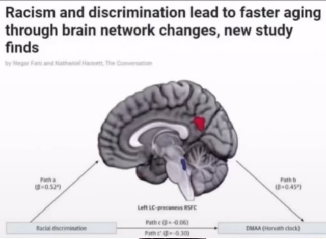 Racism and discrimination lead to faster aging through brain network ...