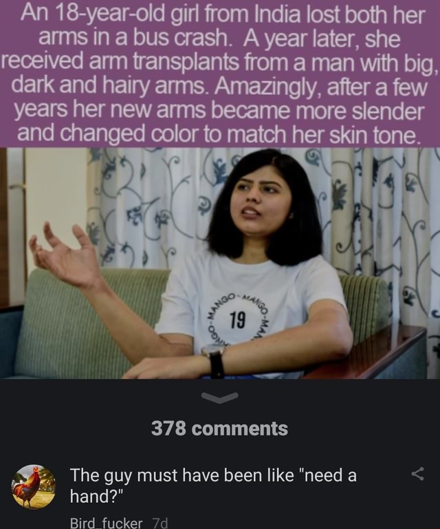 An 18-yea_ old girl from India lost both her arms in a bus crash. A ...