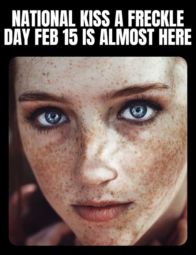 NATIONAL KISS A FRECKLE DAY FEB 15 IS ALMOST HERE - America’s best pics ...