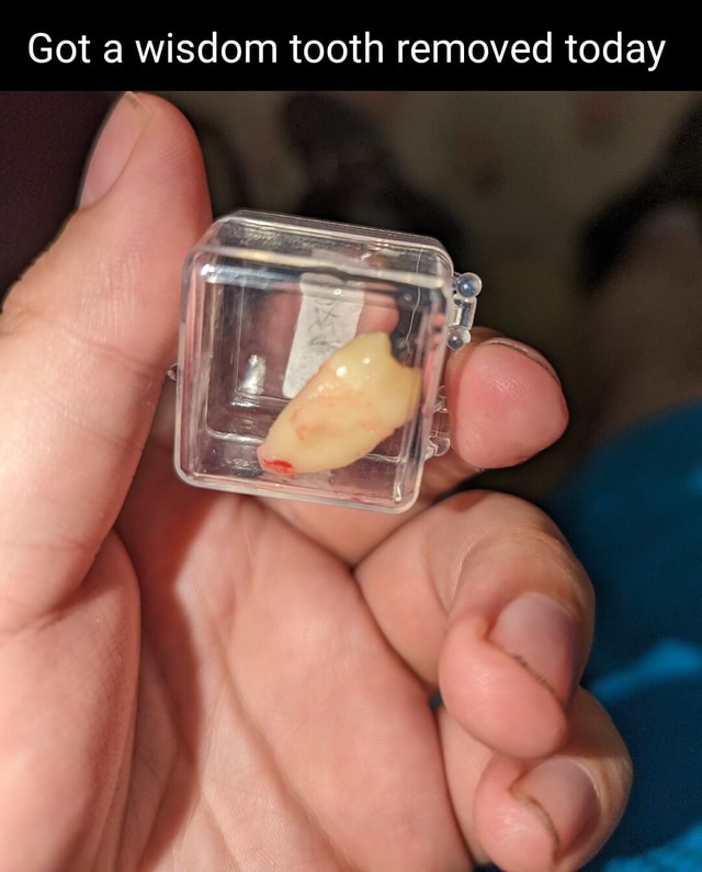 Got a wisdom tooth removed today - iFunny