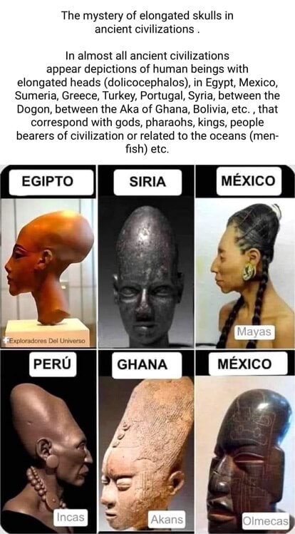 The mystery of elongated skulls in ancient civilizations In almost all ancient civilizations ...