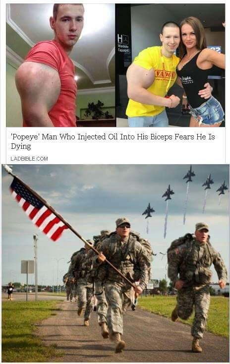 'Popeye' Man Who Injected Oil Into His Biceps Fears He Is Dying - iFunny