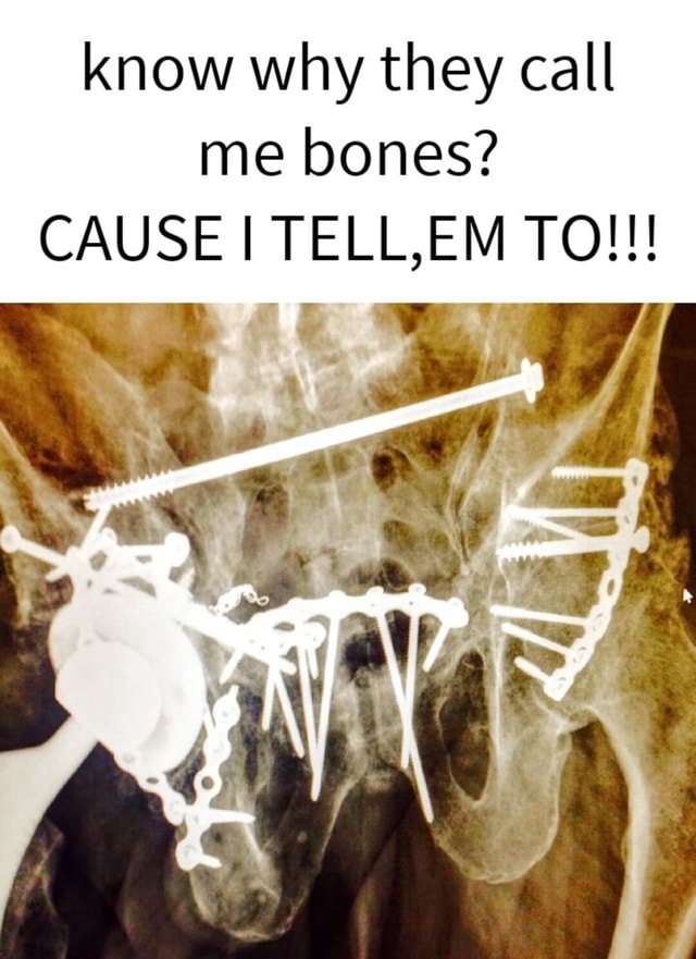 Know why they call me bones? CAUSE I TELL, EM TO!!! - iFunny