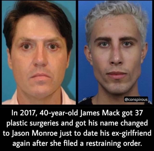 @conspirous In 2017, 40-year-old James Mack got 37 plastic surgeries ...