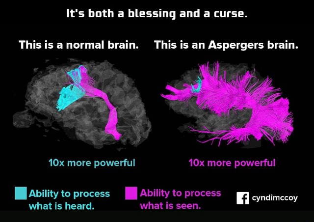 It's both a blessing and a curse. This is anormal brain. This is an ...