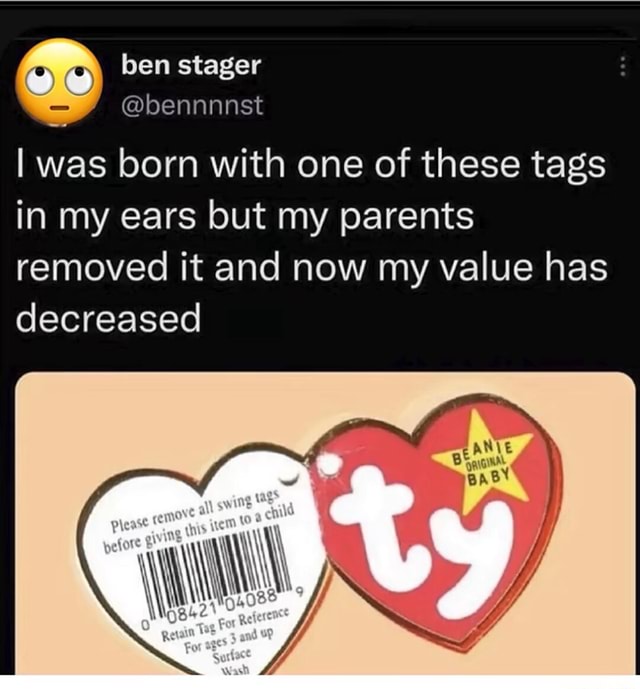 Oe ben stager I was born with one of these tags in my ears but my ...