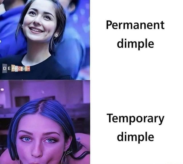 Permanent dimple Temporary dimple - iFunny