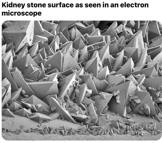 Kidney stone surface as seen in an electron microscope - iFunny