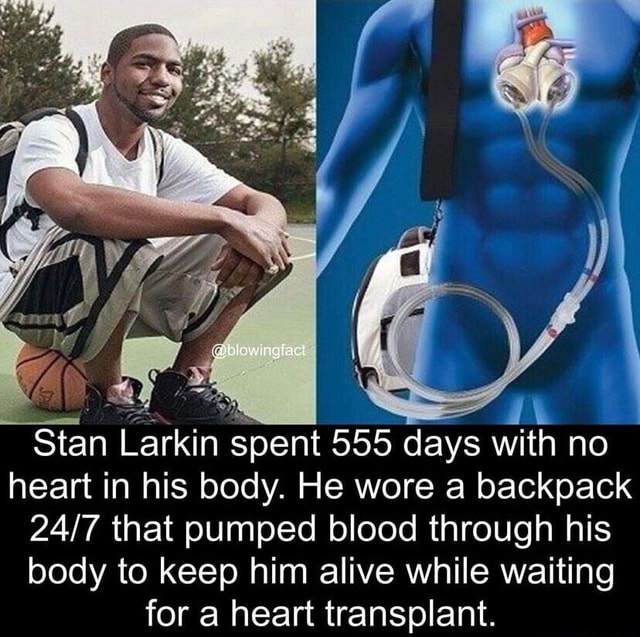 Stan Larkin spent 555 days with no heart in his body. He wore a ...