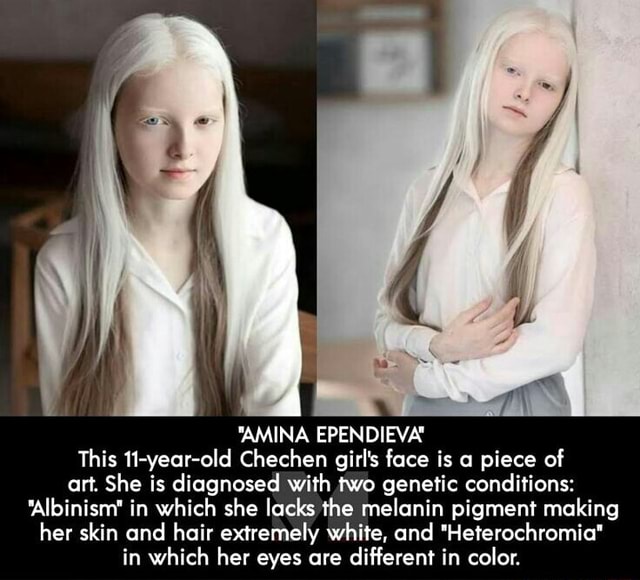 This 11-year-old Chechen girl's face is a piece of art. She is ...