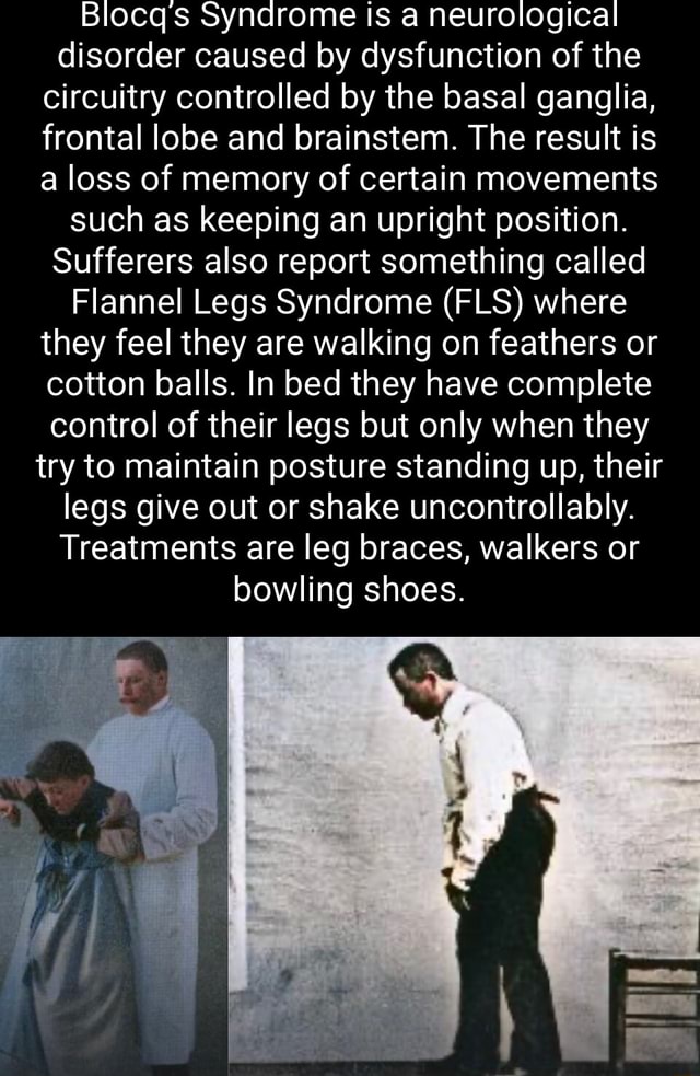 Blocqs Syndrome is a neurological disorder caused by dysfunction of the ...