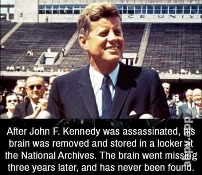 Cm ER After John F. Kennedy was assassinated, brain was removed and ...