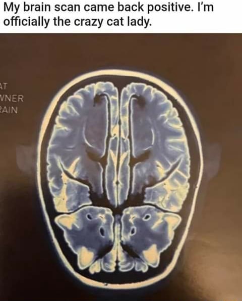 My brain scan came back positive. I'm officially the crazy cat lady ...