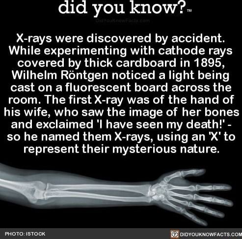 Did you know?. X-rays were discovered by accident. While experimenting ...