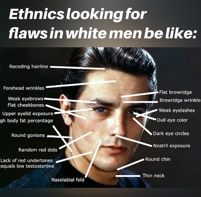 @dr.lookism Instagram - Ethnics looking for flaws in white men be like ...