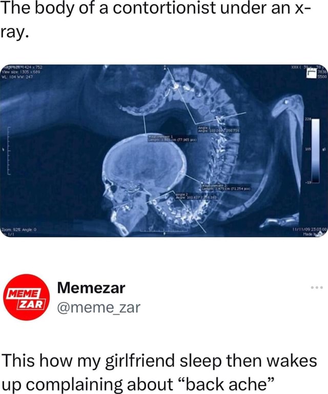 The body of a contortionist under an x- ray. Memezar MEME emeza meme ...
