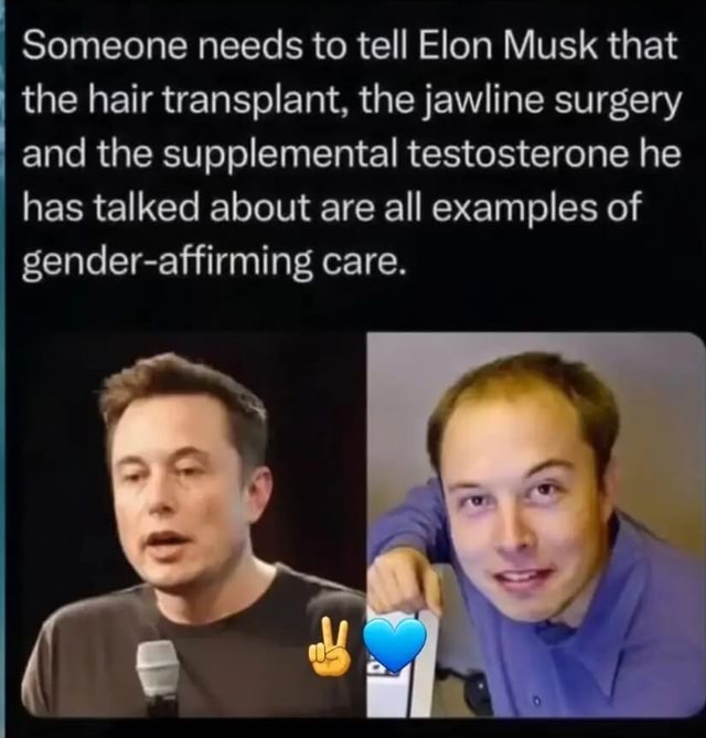 Someone needs to tell Elon Musk that the hair transplant, the jawline ...
