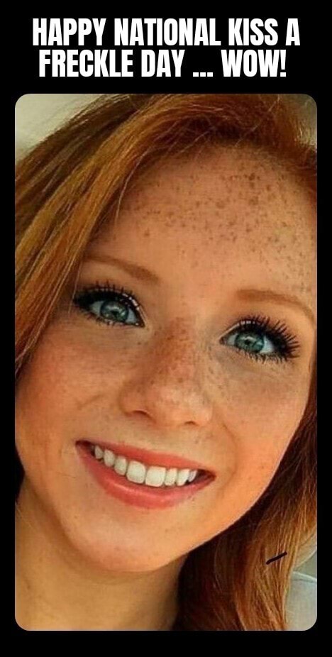 HAPPY NATIONAL KISS A FRECKLE DAY WOW! - America’s best pics and videos