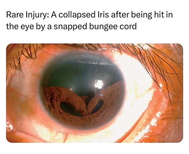 But can you still see memes explore science photography - Rare Injury ...