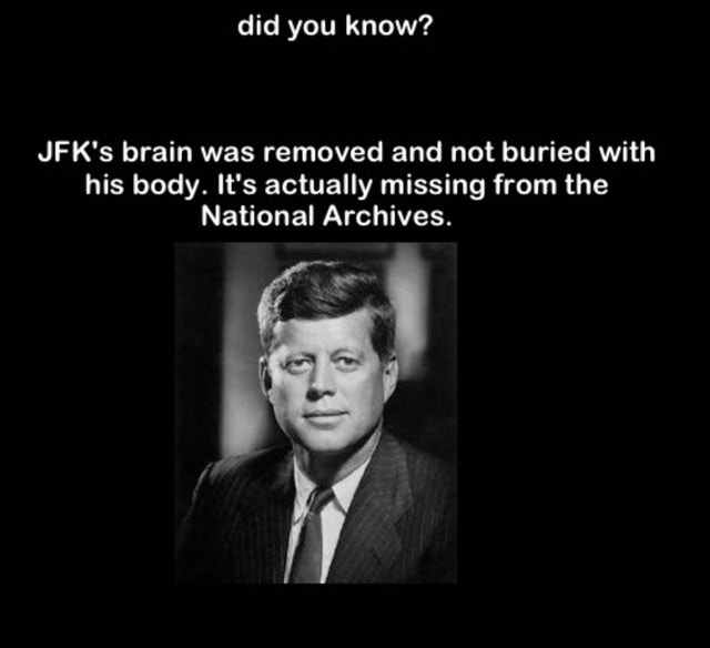 Did you know? JFK's brain was removed and not buried with his body. It ...