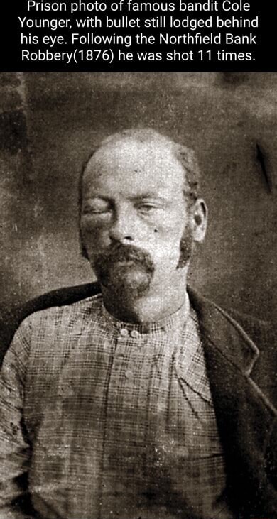 Prison photo of famous banait Cole Younger, with bullet still lodged ...