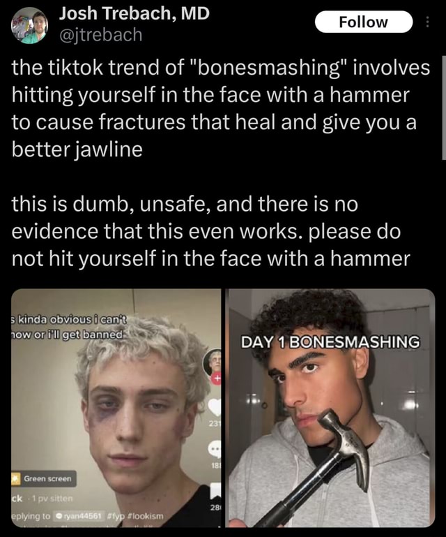 Bonesmashing rule - Josh Trebach, MD @jtrebach Follow the tiktok trend ...