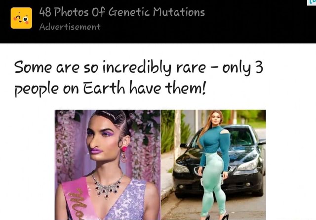 48 Photos Genetic Mutations Advertisement Some are so incredibly rare ...