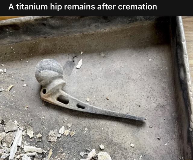 A titanium hip remains after cremation at - iFunny