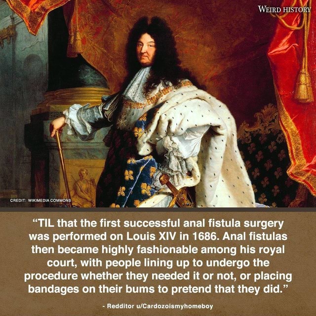 12 Strange Facts About French Royalty We Just Learned That Made Us Say ...