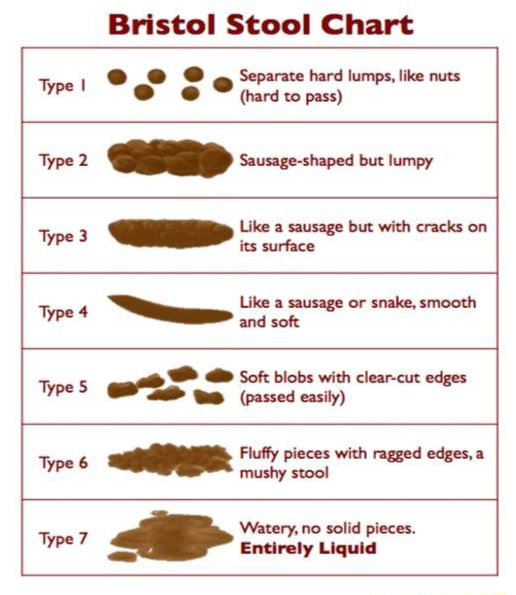 Bristol Stool Chart @ @ @ Separate hard lumps, like nuts Type (hard to ...