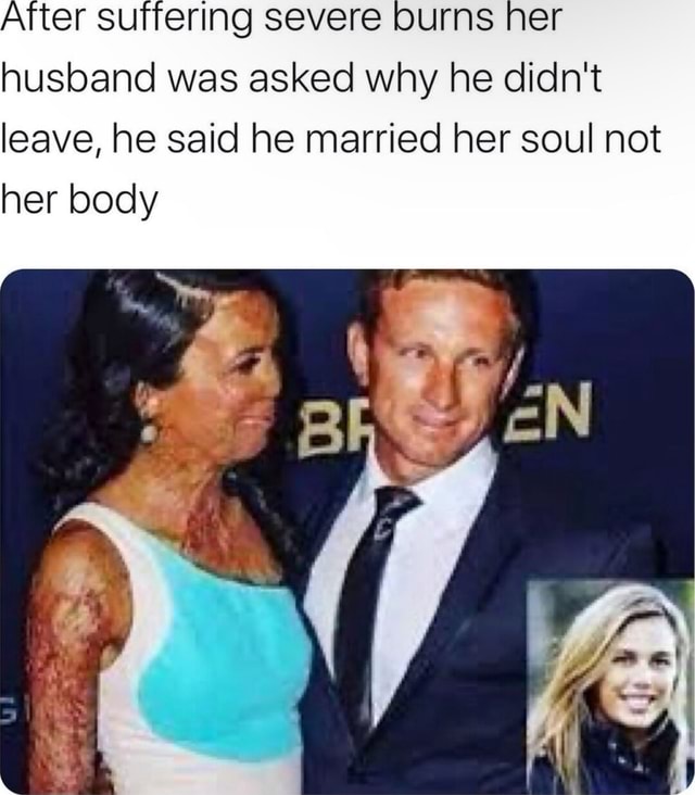 Aiter sutfering severe burns her husband was asked why he didn't leave ...