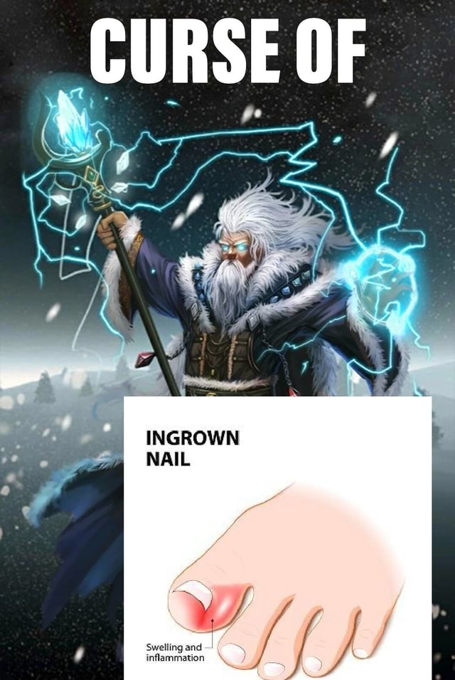 CURSE OF INGROWN NAIL Swelling and inflammation - iFunny