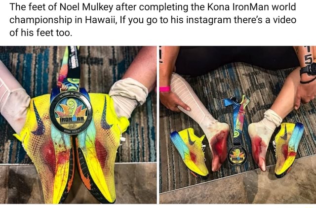 The feet of Noel Mulkey after completing the Kona IronMan world ...