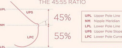 UPL NM ups 45% 55% TRE RATIO UPL Upper Pole Line NM Nipple Meridian LPL ...