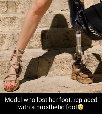 Model who lost her foot, replaced with a prosthetic - iFunny
