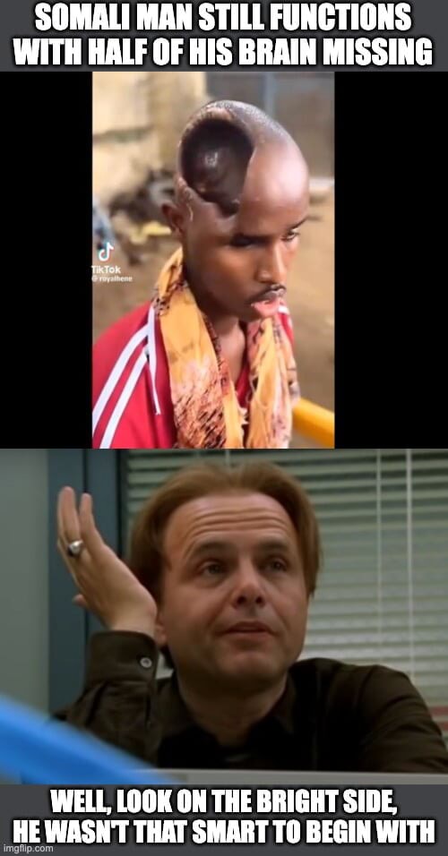 SOMALI MAN STILL FUNCTIONS WITH HALF OF HIS BRAIN MISSING WELL, LOOK ON ...