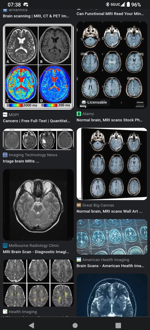 96 Britannica Can Functional Mri Read Your Min Brain Scanning I Mri