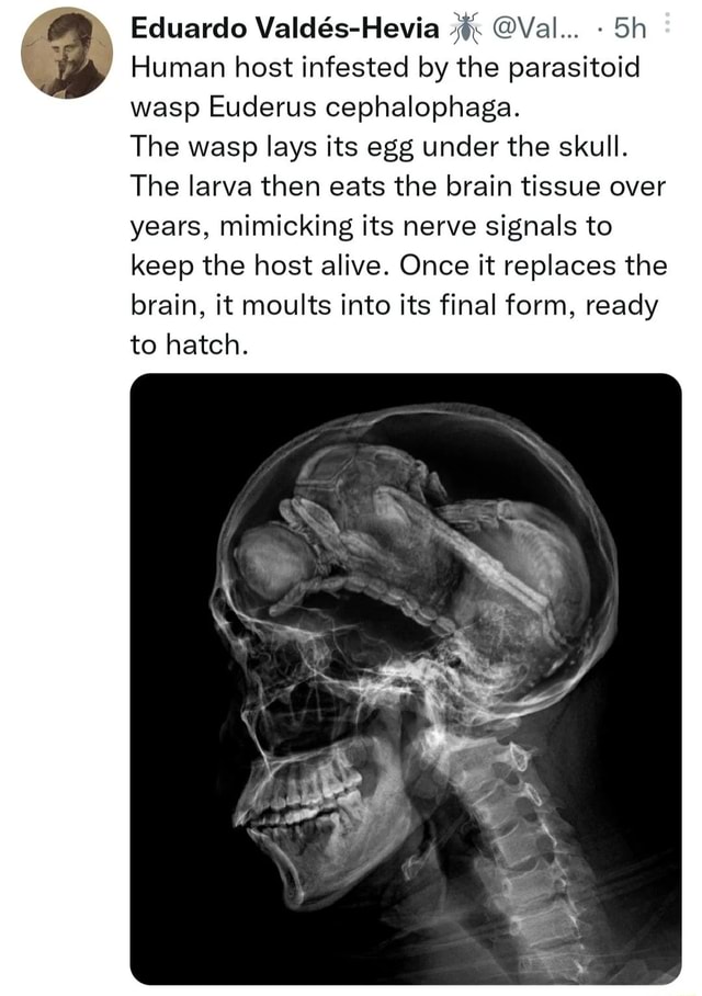 Eduardo Valds-Hevia @Val... Sh Human host infested by the parasitoid ...