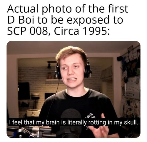 Actual photo of the first D Boi to be exposed to SCP 008, Circa 1995 ...