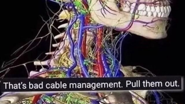 That's bad cable management. Pull them out. I - iFunny