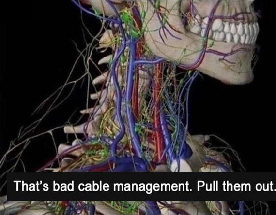 That's bad cable management. Pull them out - iFunny