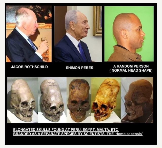 JACOB ROTHSCHILD HIMON PERE: A RANDOM PERSON (NORMAL HEAD SHAPE ...